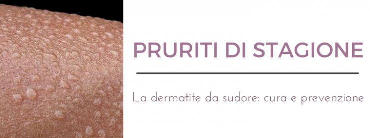 Pruriti di stagione: la dermatite da sudore - Prof. Antonino Di Pietro
