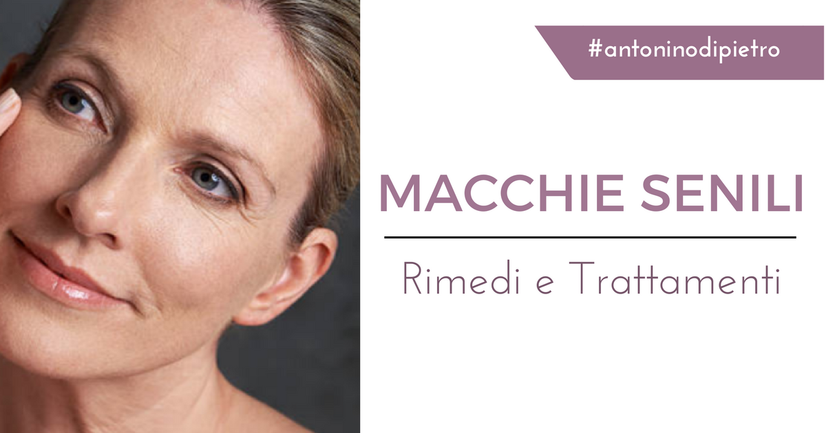 Macchie senili: rimedi, trattamenti mirati per eliminarle, prevenzione